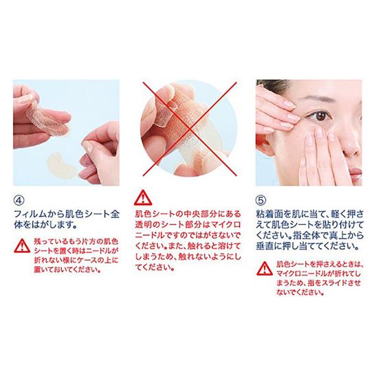 クオニス ダーマフィラー アイニードル 8回+2回分【送料無料】[A251701] | テレビ通販サイトのカンテレSHOPPING