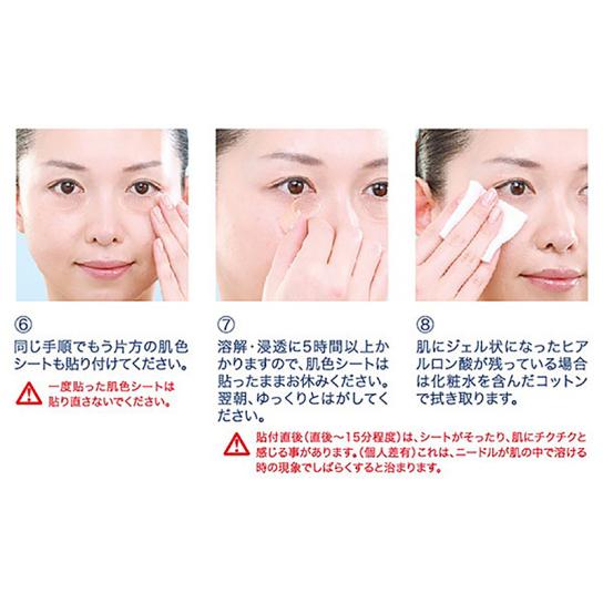 クオニス ダーマフィラー アイニードル 8回+2回分【送料無料】[A251701] | テレビ通販サイトのカンテレSHOPPING